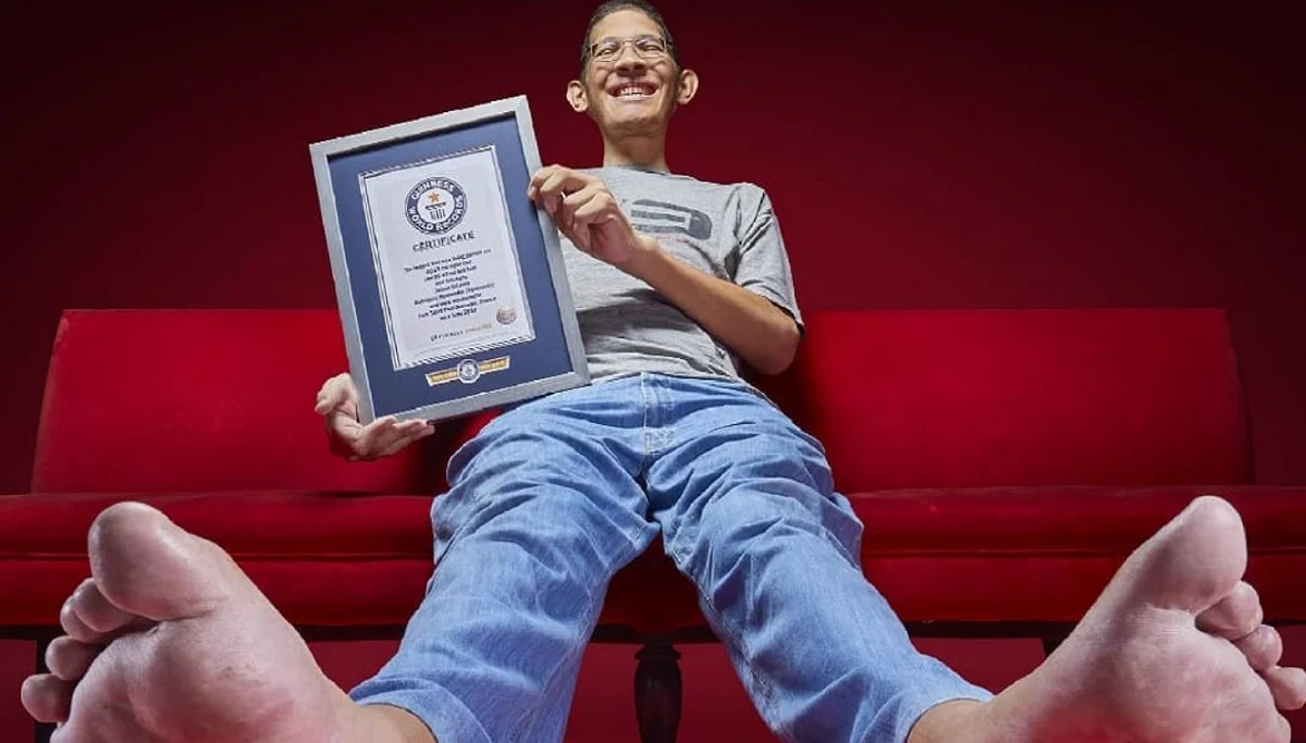 Venezolano con los pies más grandes del mundo pide ayuda para costear ...
